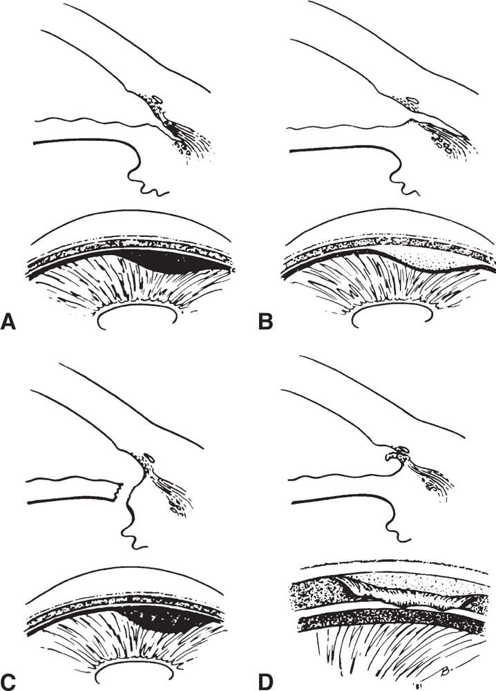 Clinical Evaluation | Ento Key