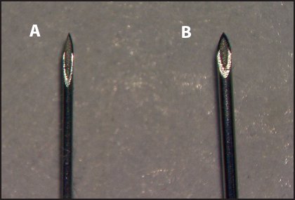 Yamane Double Needle Technique Rationale And Results Ento Key
